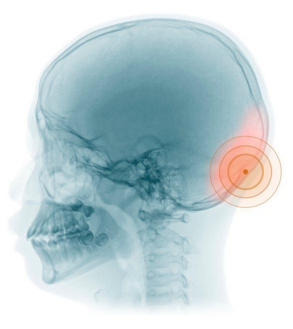 Common Types of Brain Injuries | Demas Law Group, P.C.